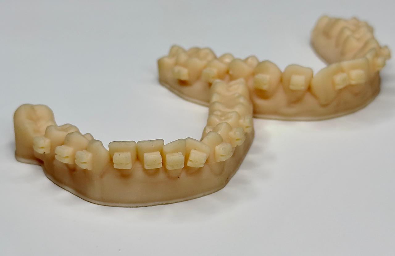 Fixed Orthodontic Treatment | Indirect Bonding Trays & Bracket